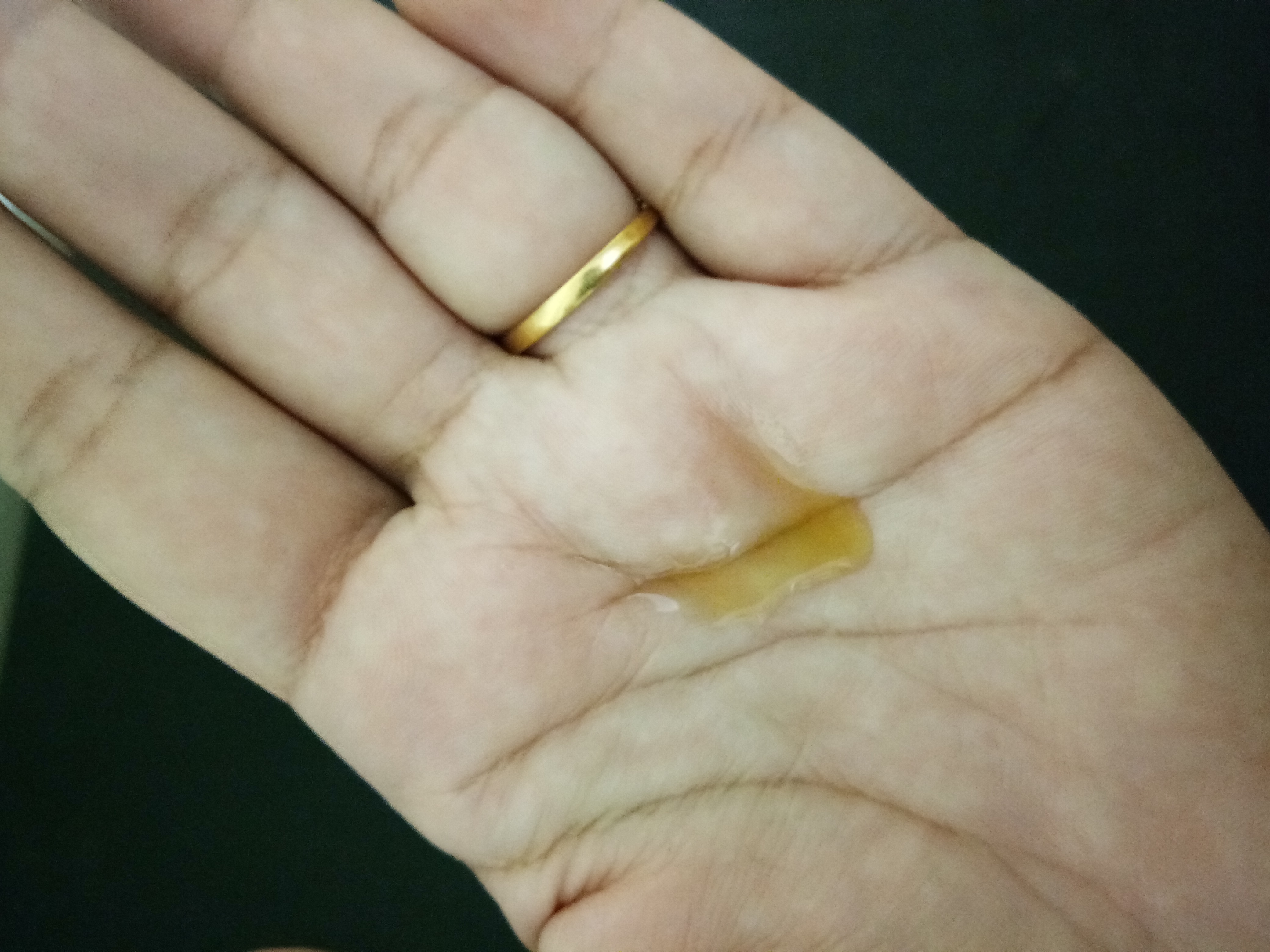Nature Sure Leech Jonk Tail – Leech Oil Review - makeupadda